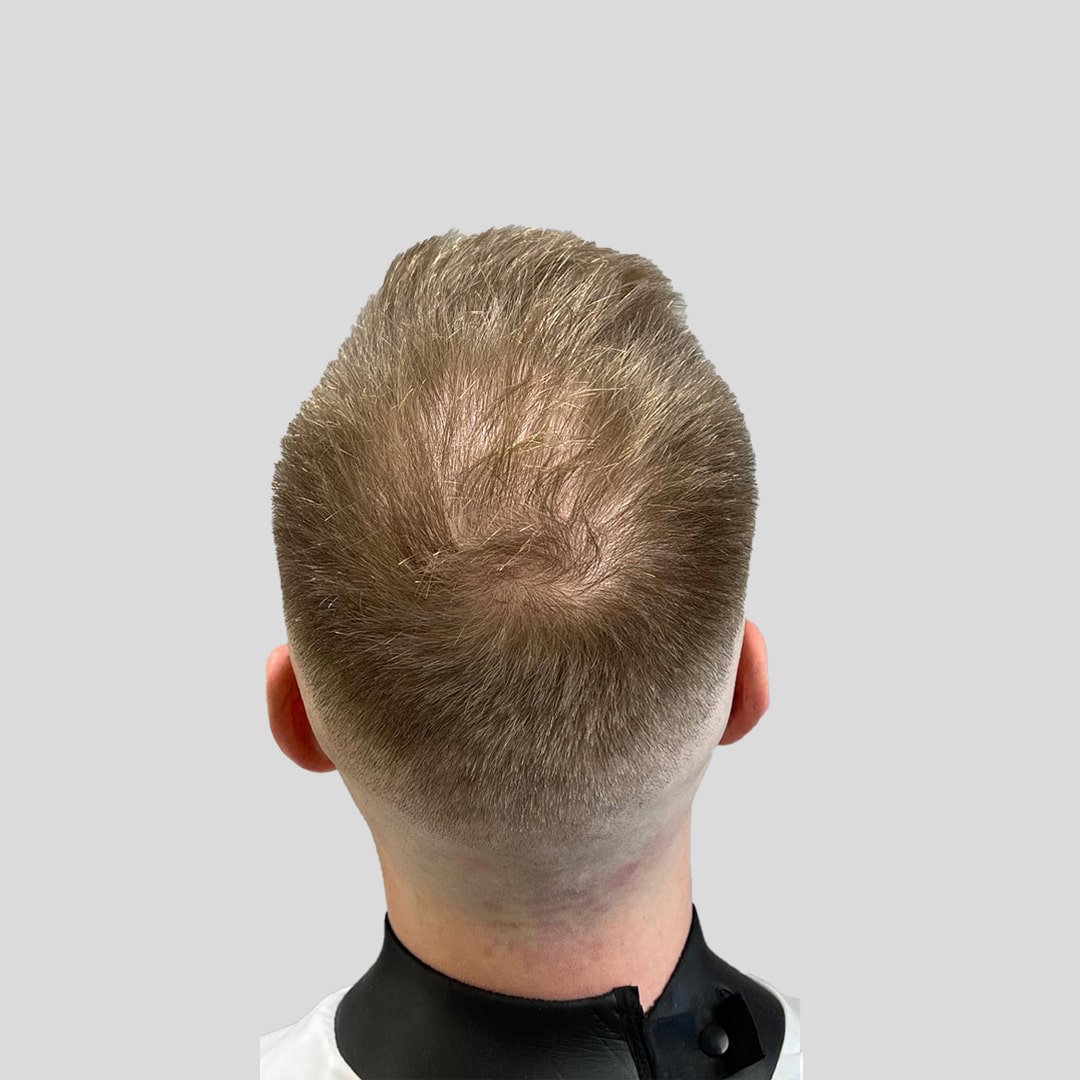 FoliGlow | Natural Hair Fiber Powder & Accessories for Thicker hair